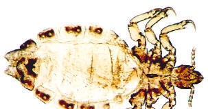 Läuse sind kein Problem mangelnder Hygiene - STIMME.de